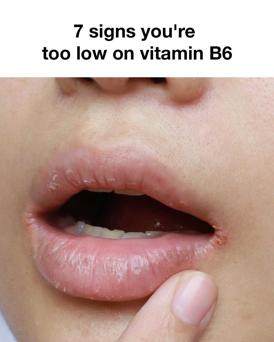 7 signs you’re too low on vitamin b6 – all recipes fun