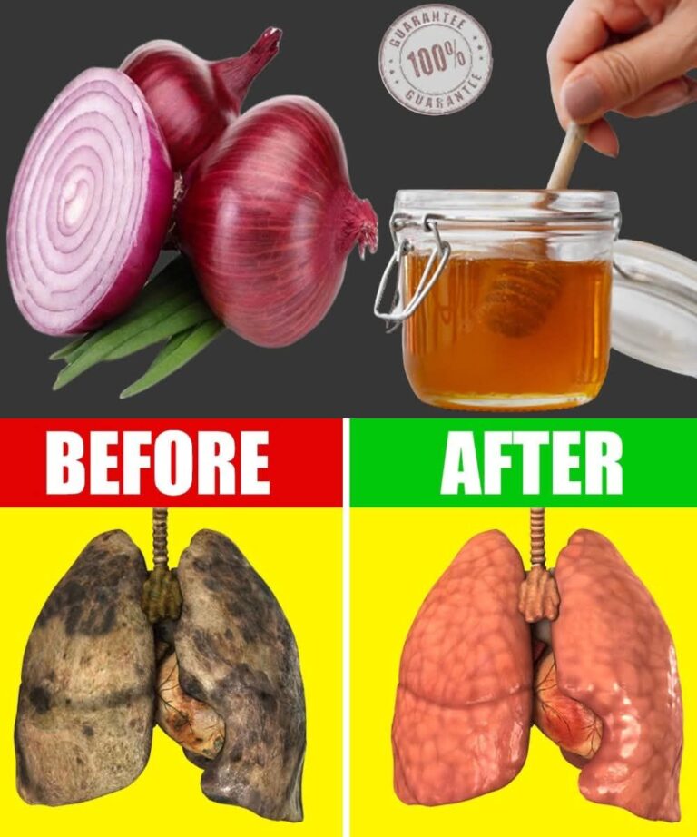 🌬️ Clear Your Lungs and Relieve Cough in 1 Day: The Onion and Honey ...